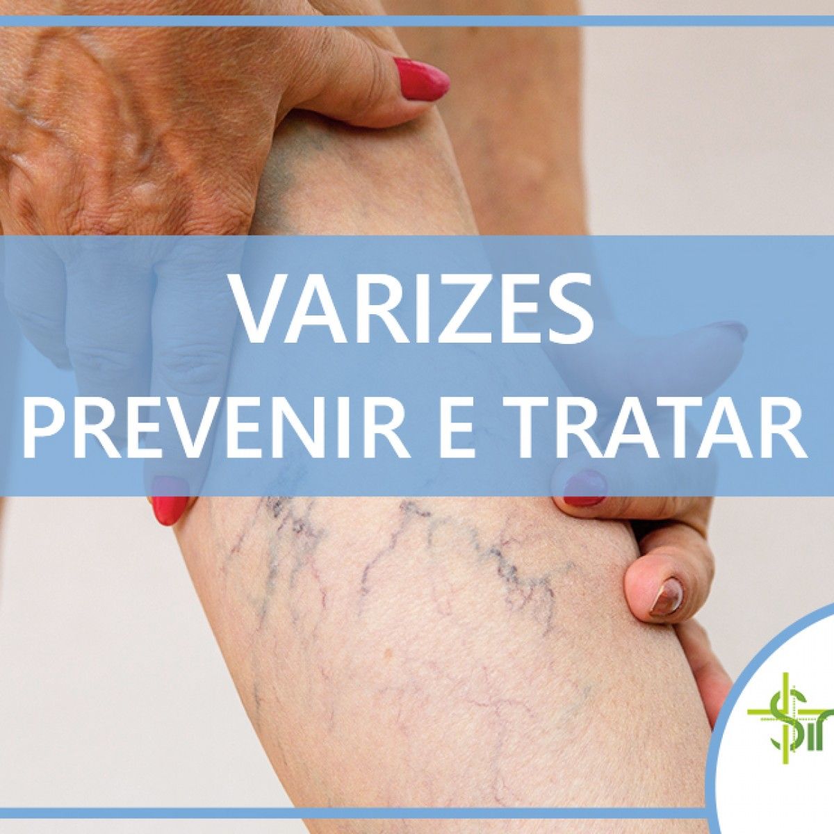 Varizes: Prevenir e Tratar | SimplesFarma